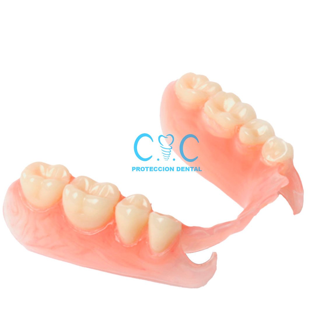 Proteccion Dental - Protesis dental flexible superior